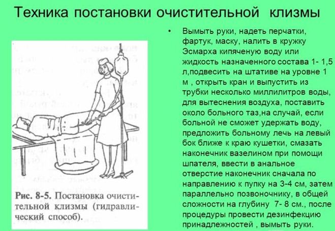 На каком боку делать клизму?